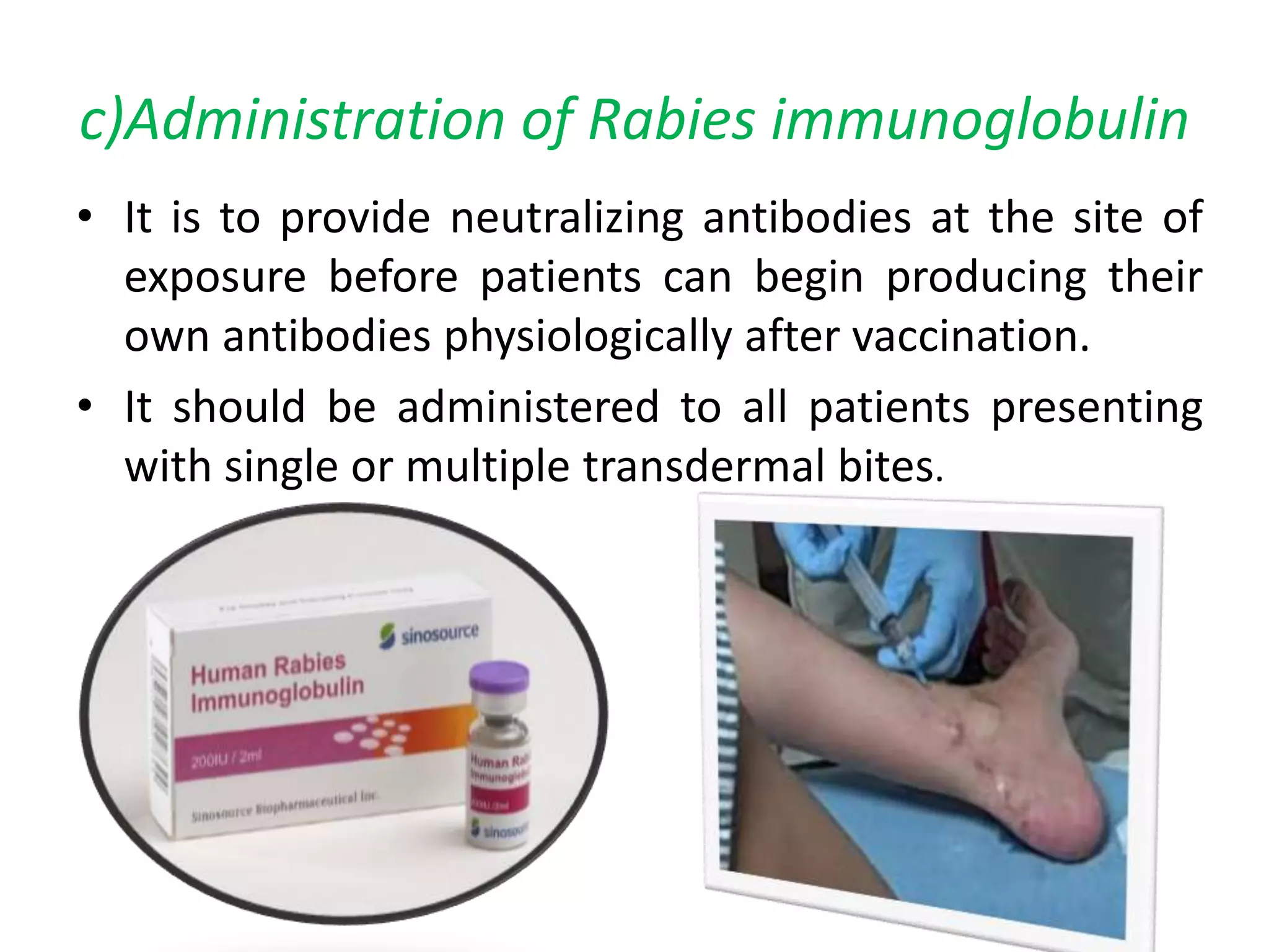 Rabies prevention and control | PPTX