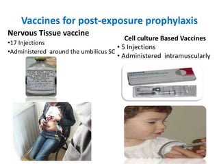 Rabies prevention and control | PPTX