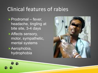 Aerophobia Rabies