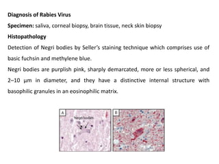Rabies virus | PPTX