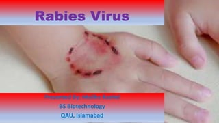 Rabies Virus_Presentation_by_Maliha_Rashid.pptx