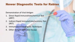 Rabies Virus_Presentation_by_Maliha_Rashid.pptx