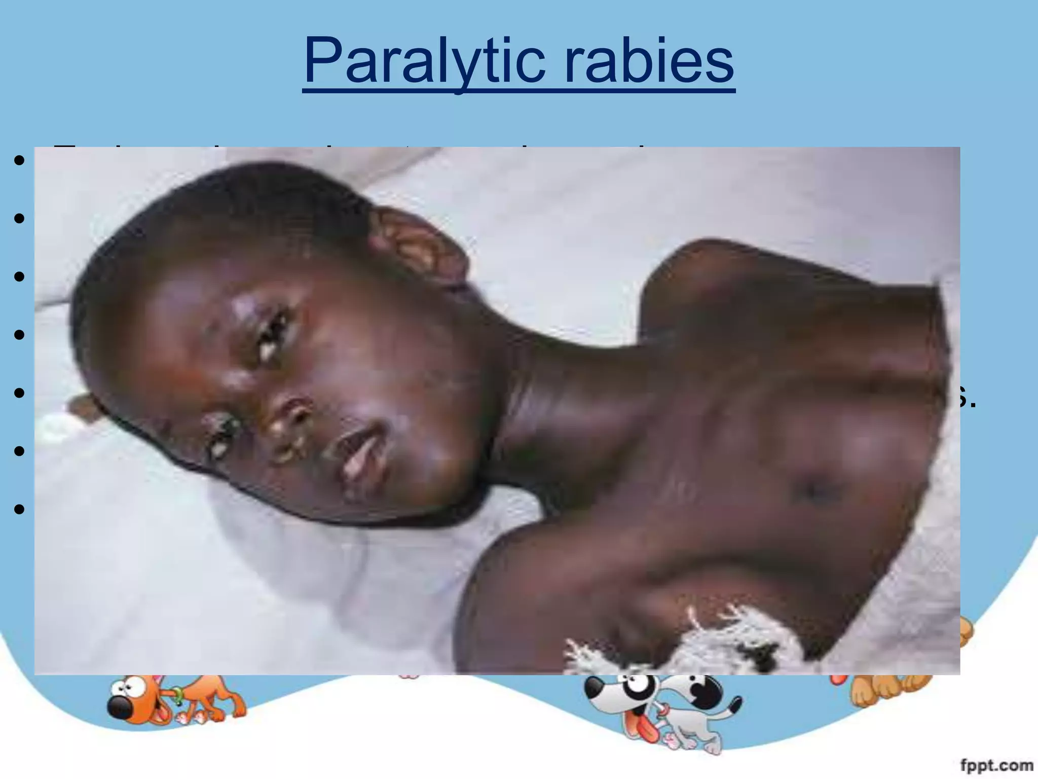 Rabies | PPTX