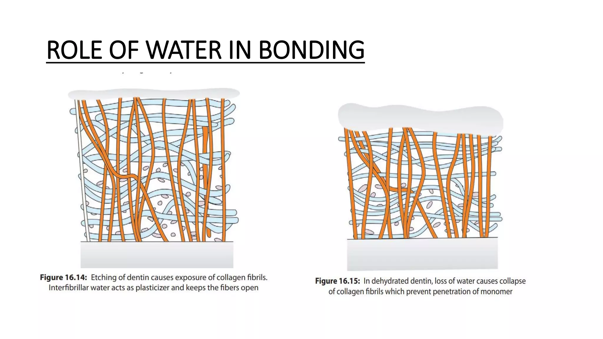 rabin dry bonding and wet bonding 1.pptx