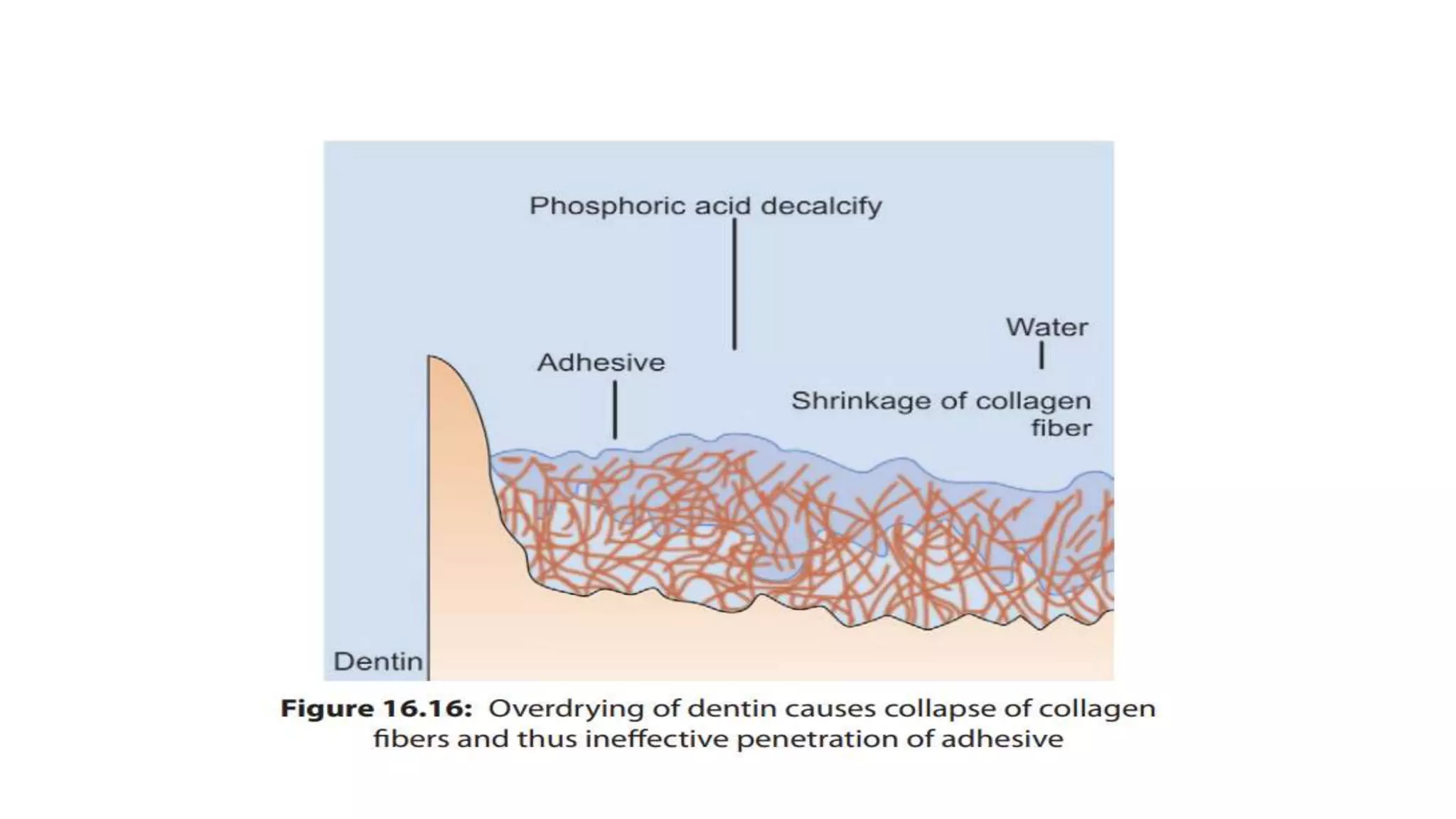 rabin dry bonding and wet bonding 1.pptx