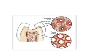 rabin dry bonding and wet bonding 1.pptx