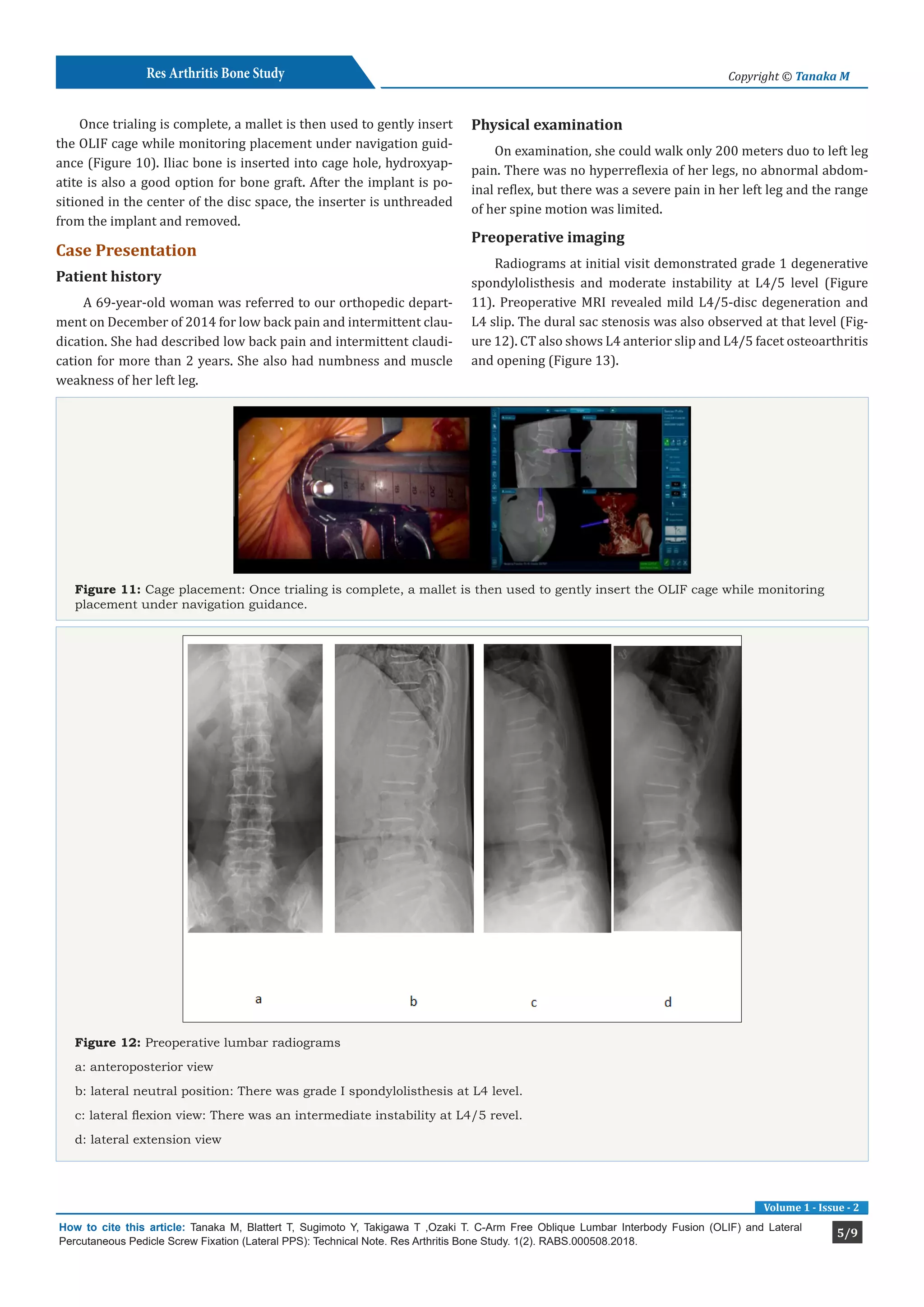 C-Arm Free Oblique Lumbar Interbody Fusion (OLIF) and Lateral ...