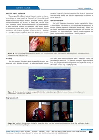 C-Arm Free Oblique Lumbar Interbody Fusion (OLIF) and Lateral ...