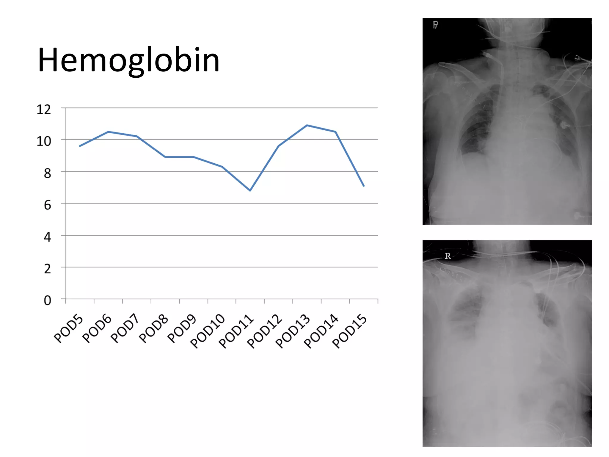 Aortic SUrgry, Hemostatic Tips | PPT