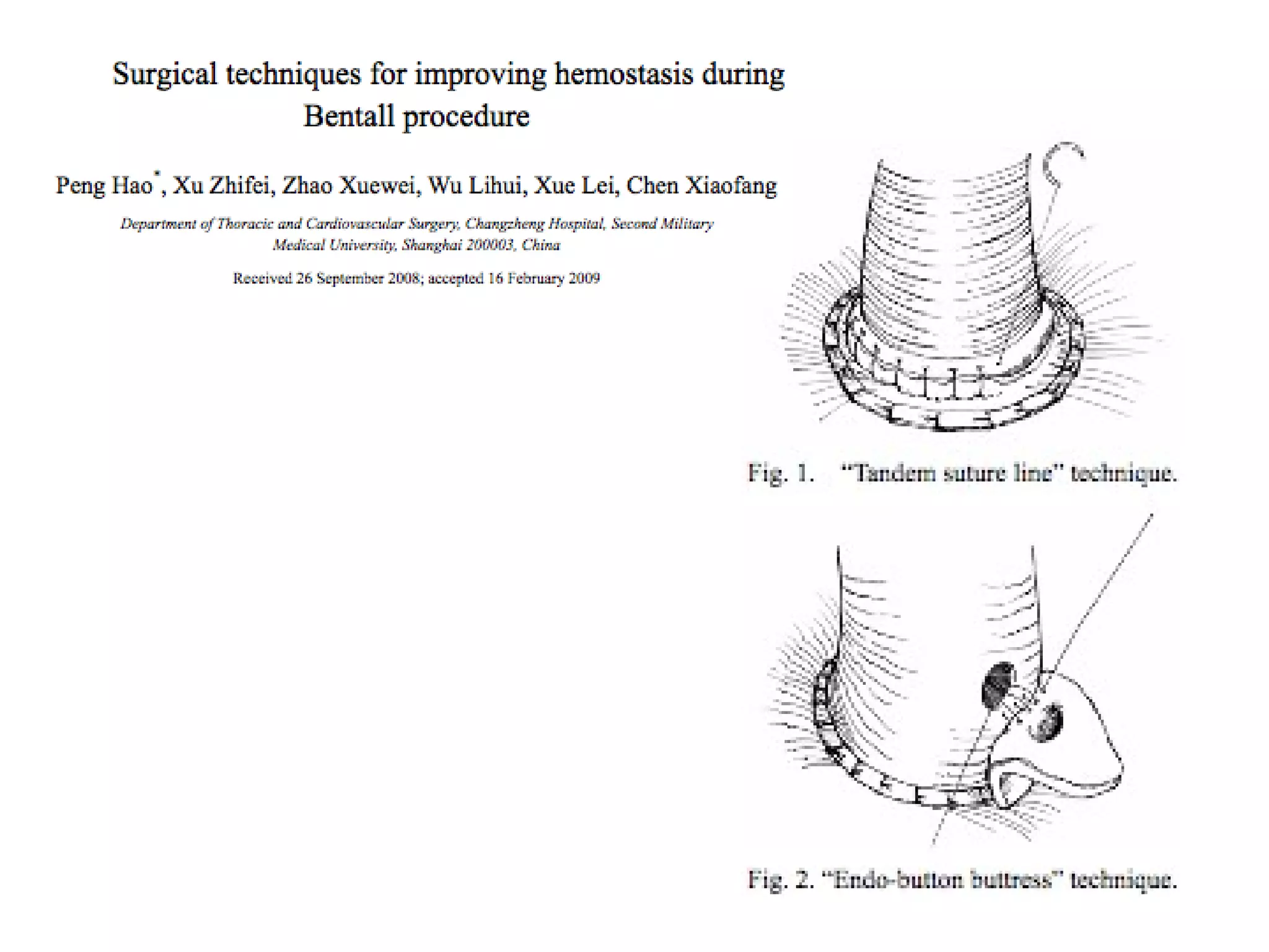 Aortic SUrgry, Hemostatic Tips | PPT