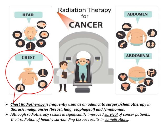 Radiation Associated Cardiac Disease | PPT