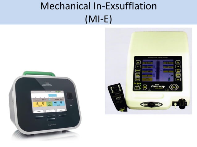 Managing respiratory symptoms in advanced MS | PPT