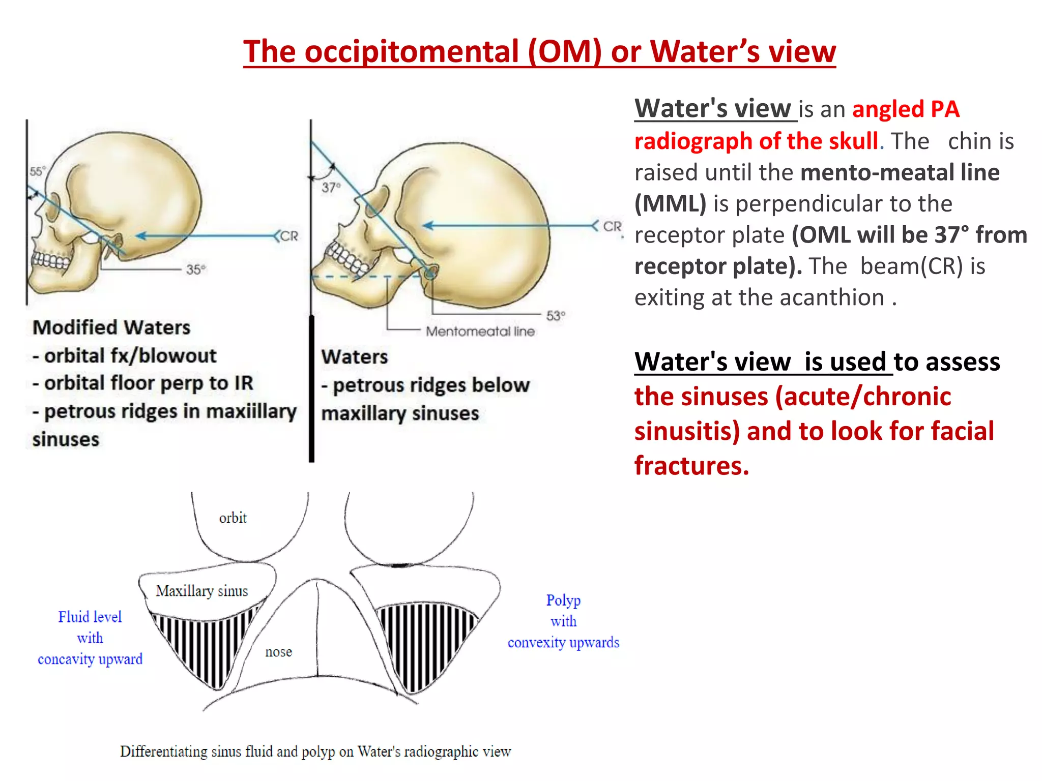 Radiological anatomy of the Head and Neck | PDF