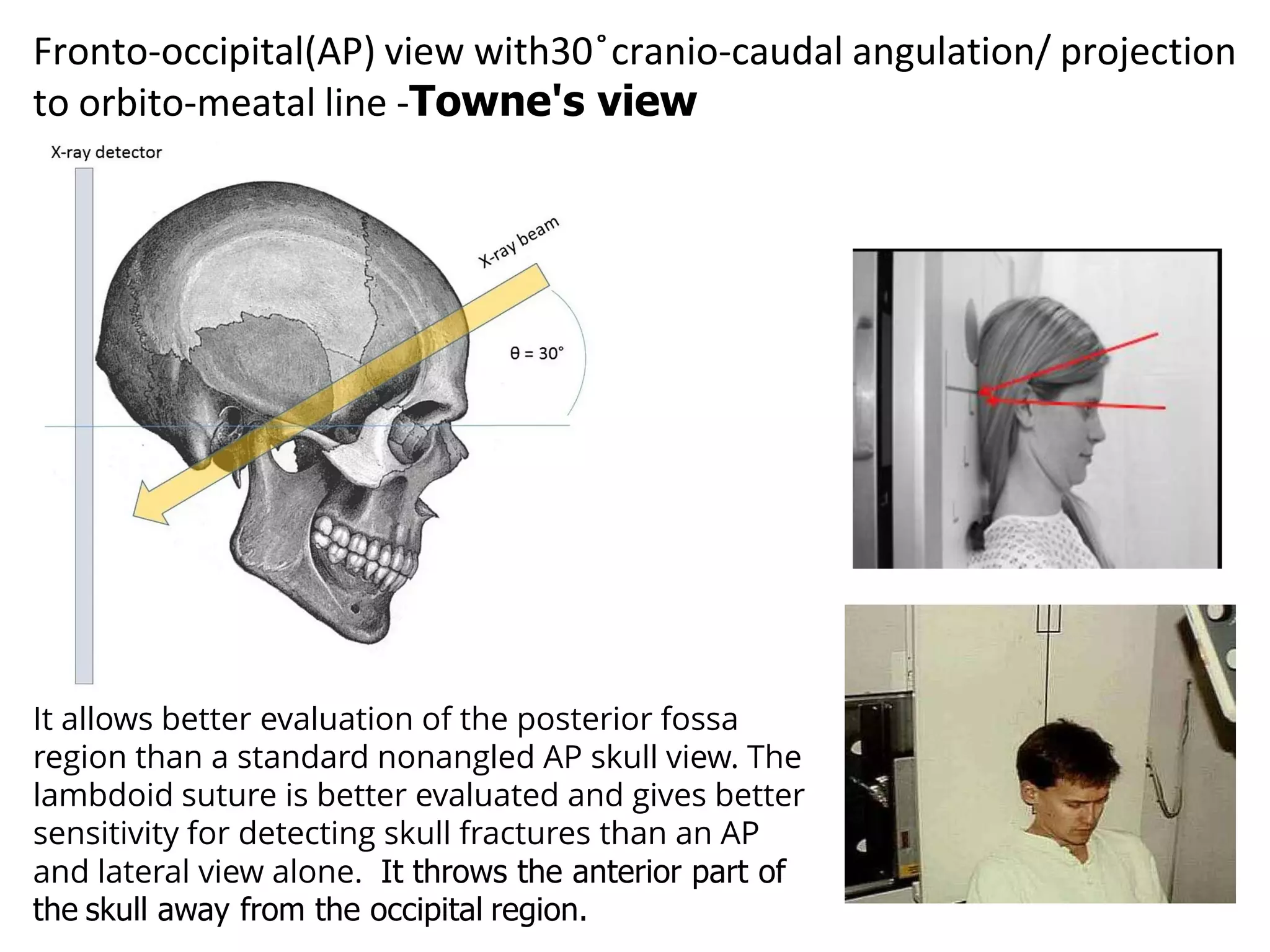 Radiological anatomy of the Head and Neck | PDF