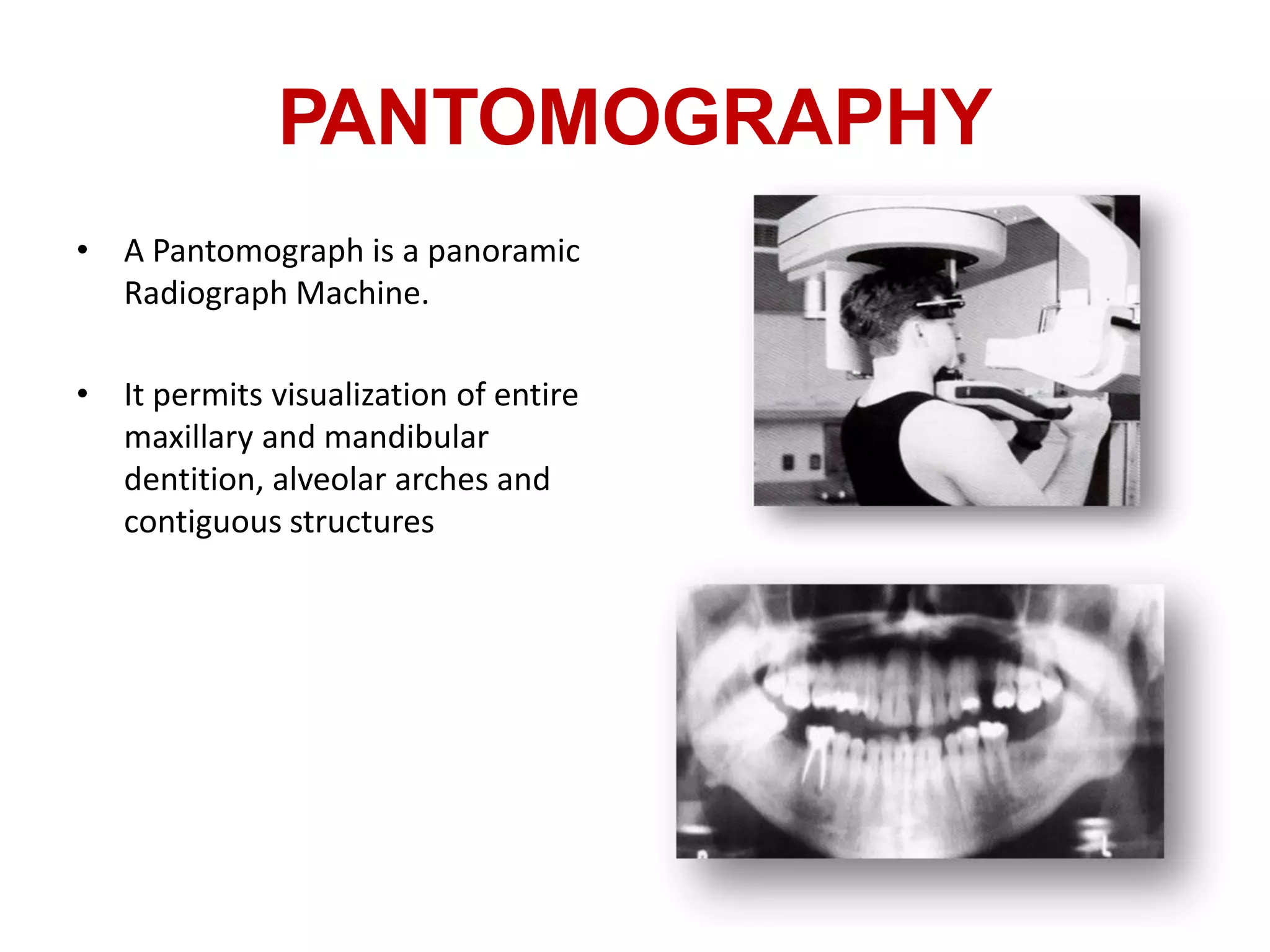 Radiological anatomy of the Head and Neck | PDF