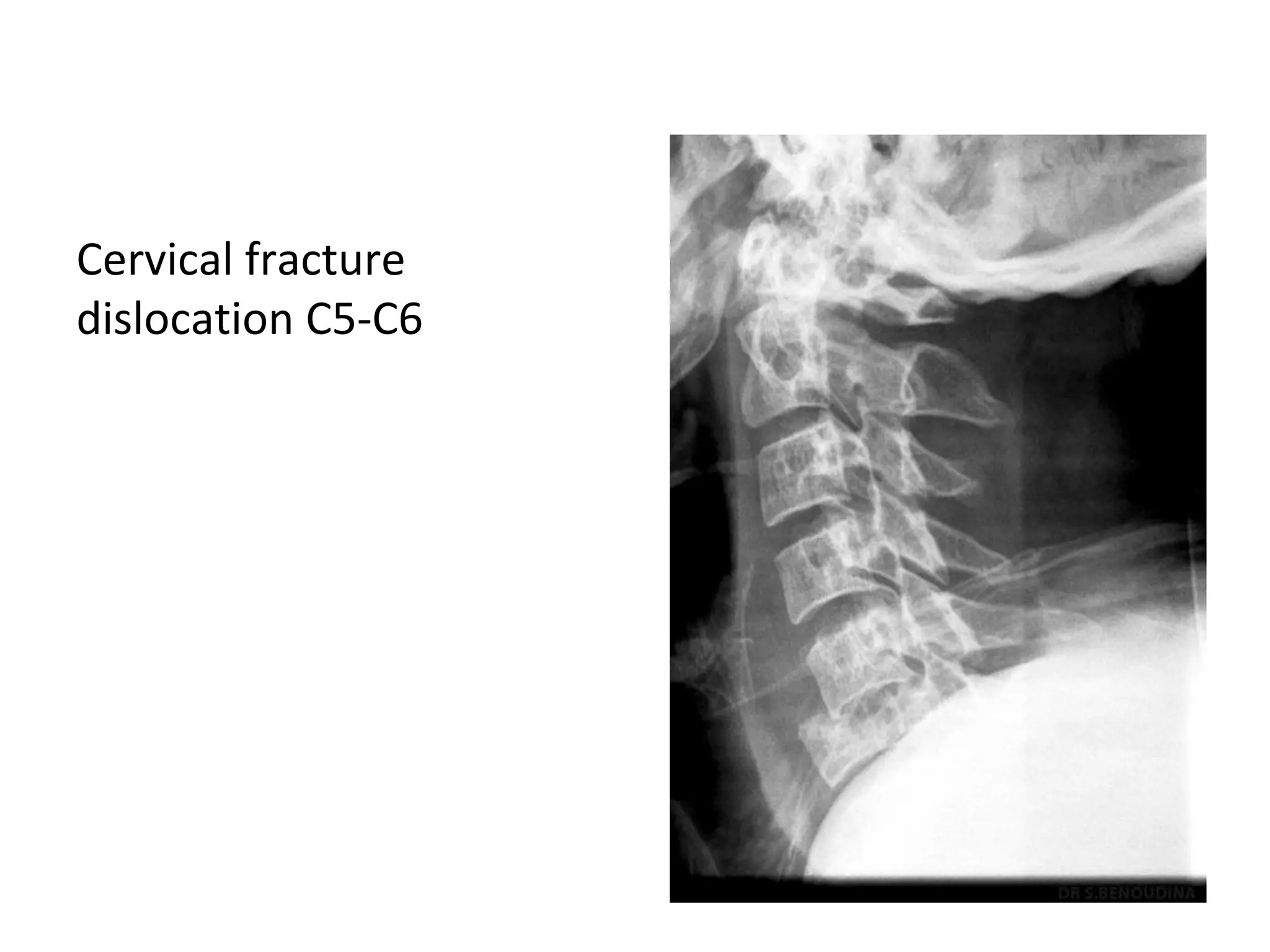 Radiological anatomy of the Head and Neck | PDF