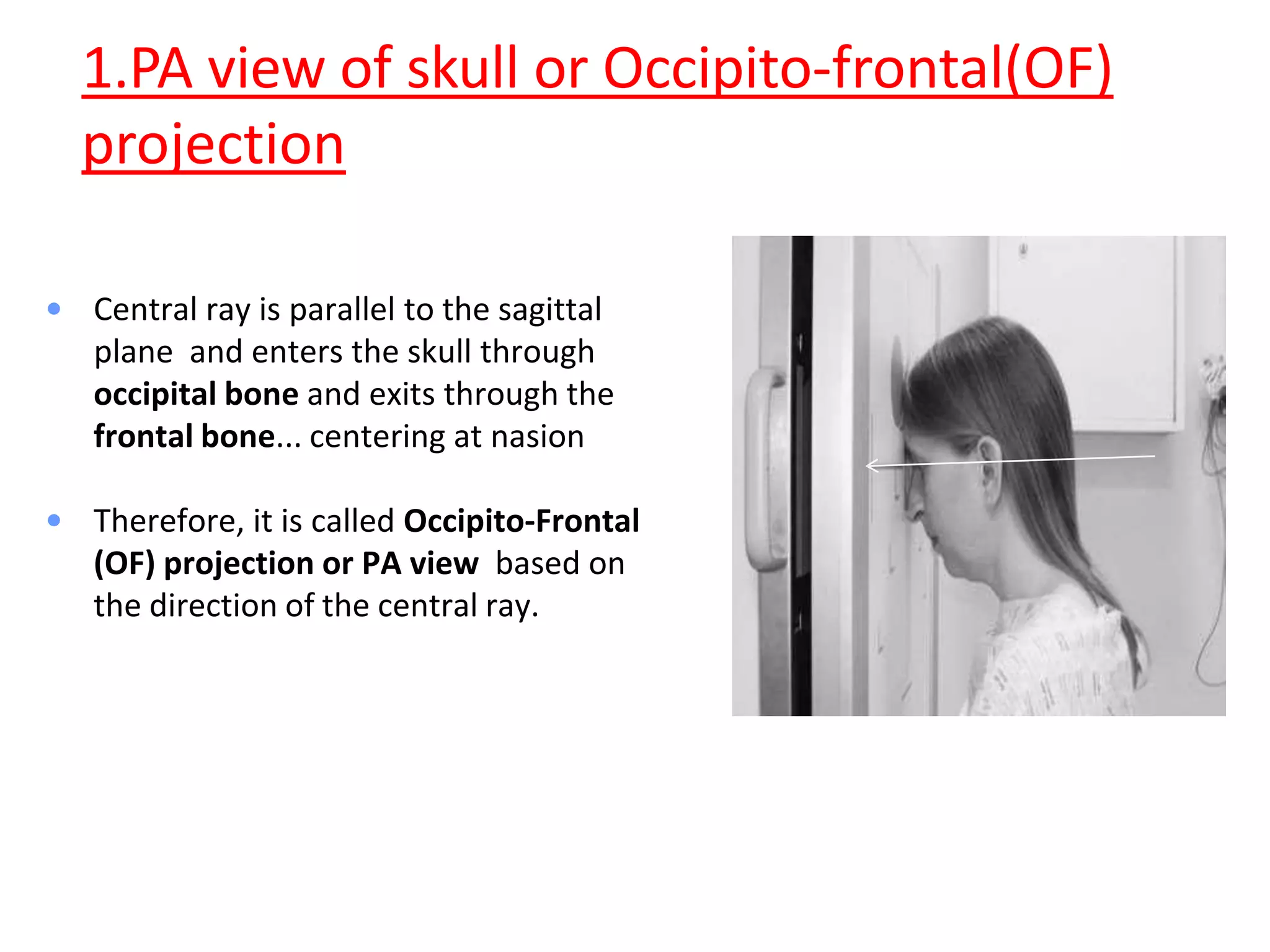 Radiological anatomy of the Head and Neck | PDF