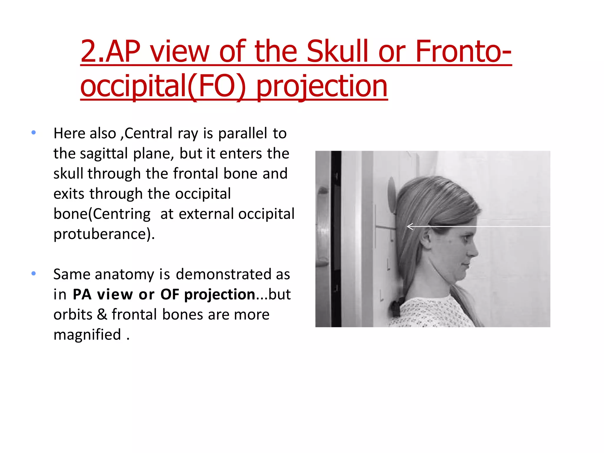 Radiological anatomy of the Head and Neck | PDF