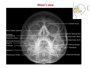 Radiological anatomy of the Head and Neck | PDF