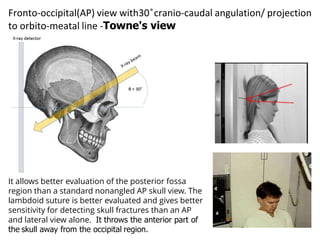 Radiological anatomy of the Head and Neck | PDF