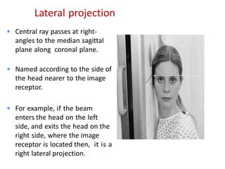 Radiological anatomy of the Head and Neck | PDF