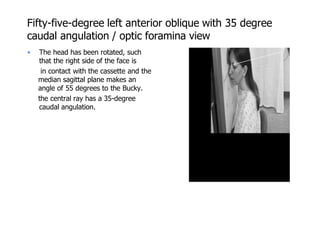 Radiological anatomy of the Head and Neck | PDF