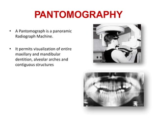 Radiological anatomy of the Head and Neck | PDF