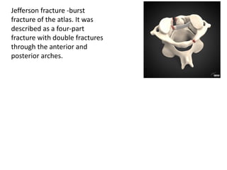 Radiological anatomy of the Head and Neck | PDF
