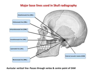 Radiological anatomy of the Head and Neck | PDF