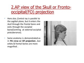 Radiological anatomy of the Head and Neck | PDF