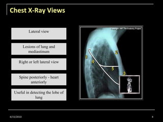 Radiology for Undergraduate Part 1 | PPTX