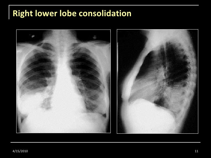 Radiology for Undergraduate Part 1