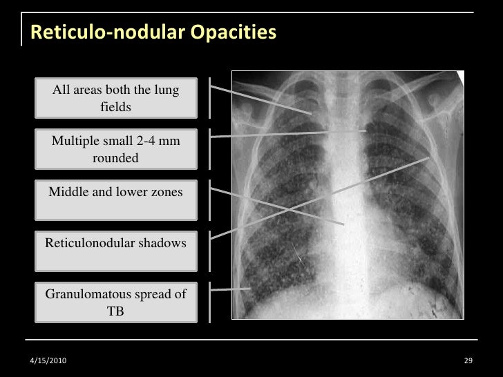 Radiology for Undergraduate Part 1