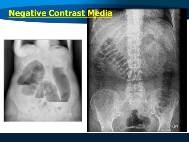 Rad 104 hospital practice and care of patients 3 drugs & contras…
