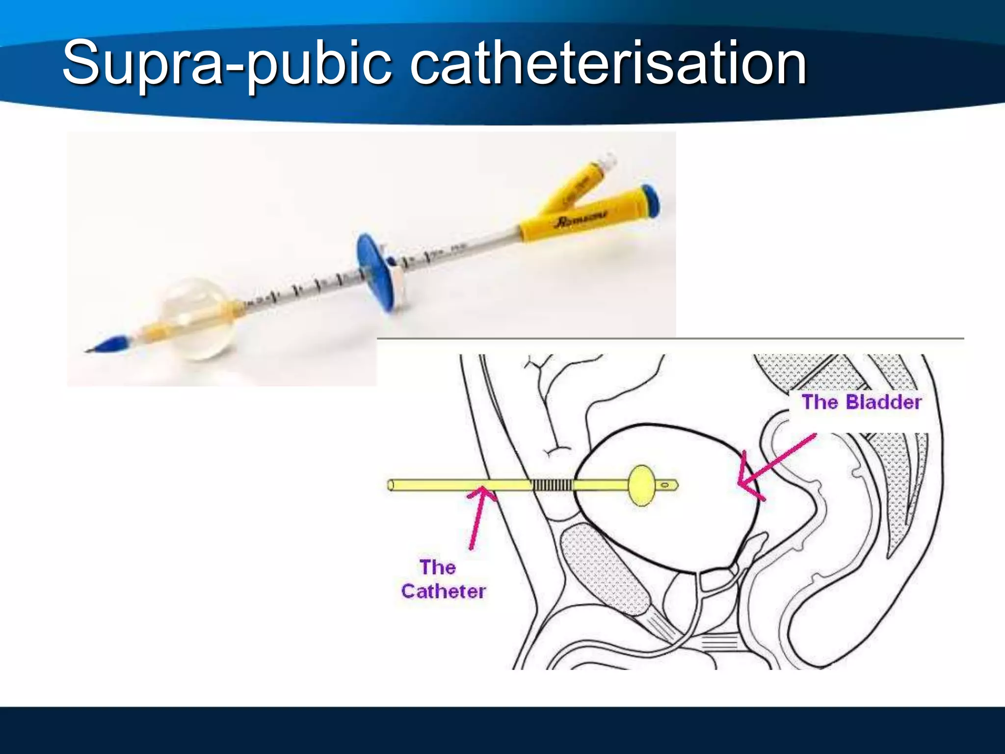 Rad 104 hospital practice and care of patients 8 types of catheters ...