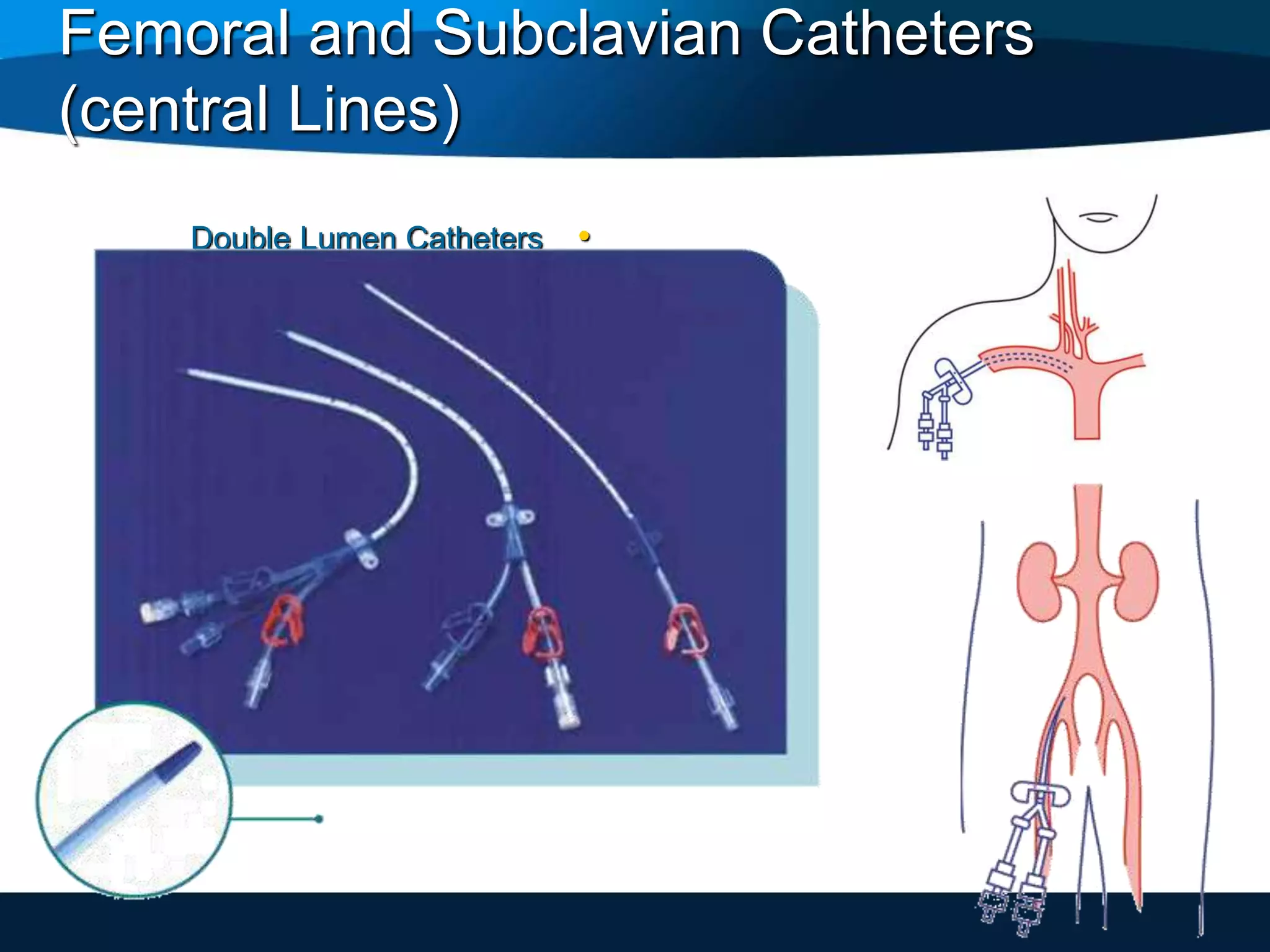 Rad 104 hospital practice and care of patients 8 types of catheters ...