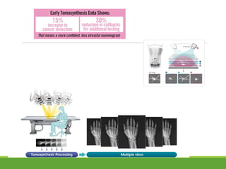Rad 206 p05 Fundamentals of Imaging - Fluoroscopy | PPT