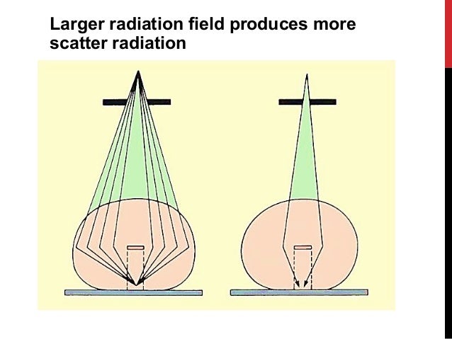 Rad 206 p11 Fundamentals of Imaging - Control of Scatter Radiation