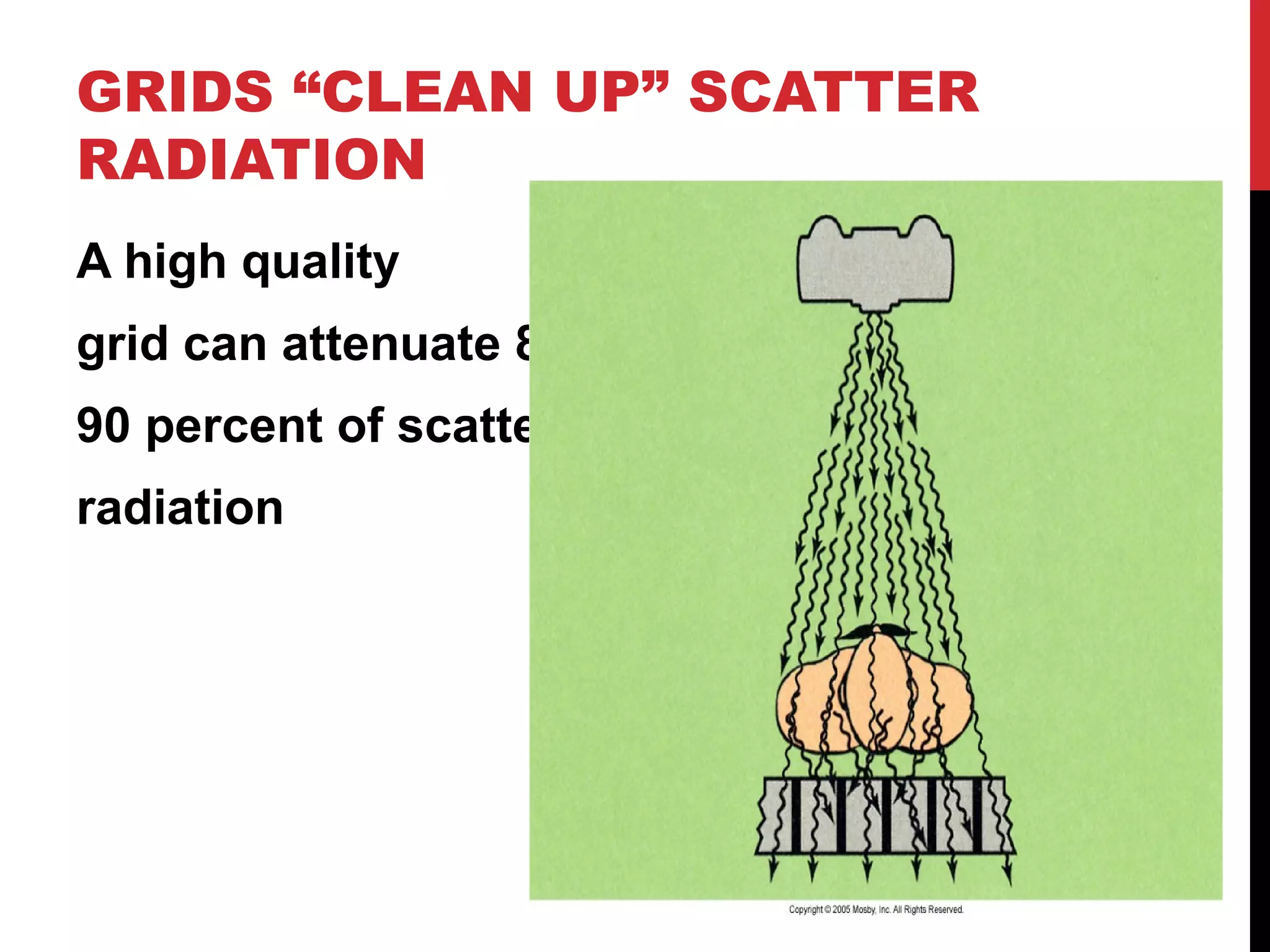 Rad 206 p12 Fundamentals of Imaging - Control of Scatter Radiation | PPT