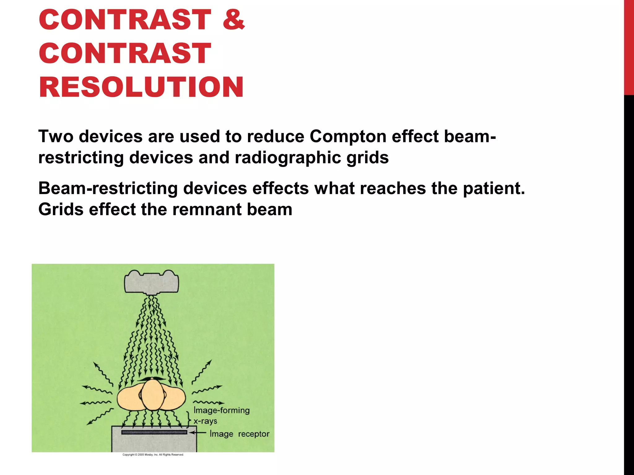 Rad 206 p12 Fundamentals of Imaging - Control of Scatter Radiation | PPT