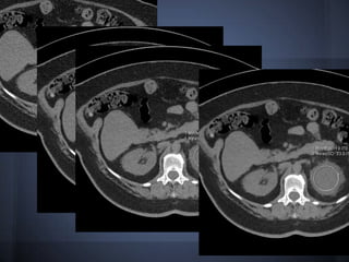 Radaim siemens lecture | PPTX