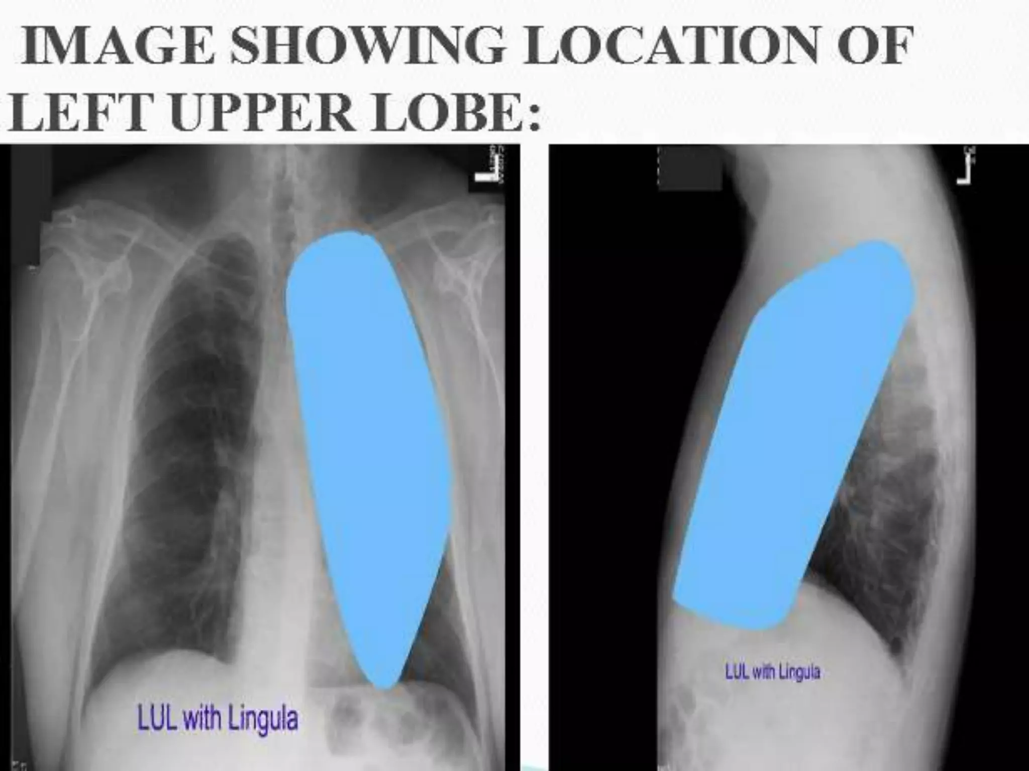 rad ana of chest.pdf