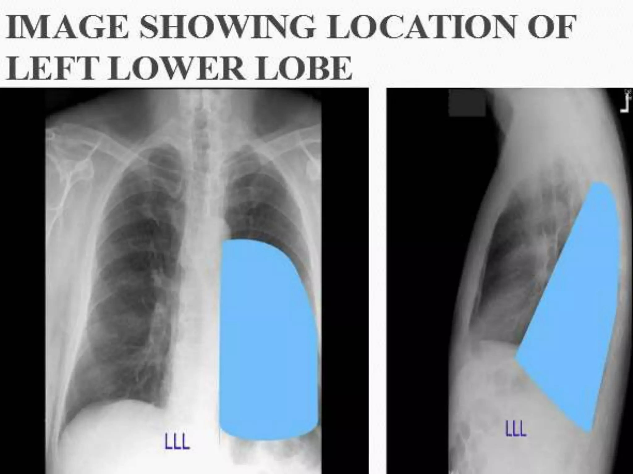 rad ana of chest.pdf