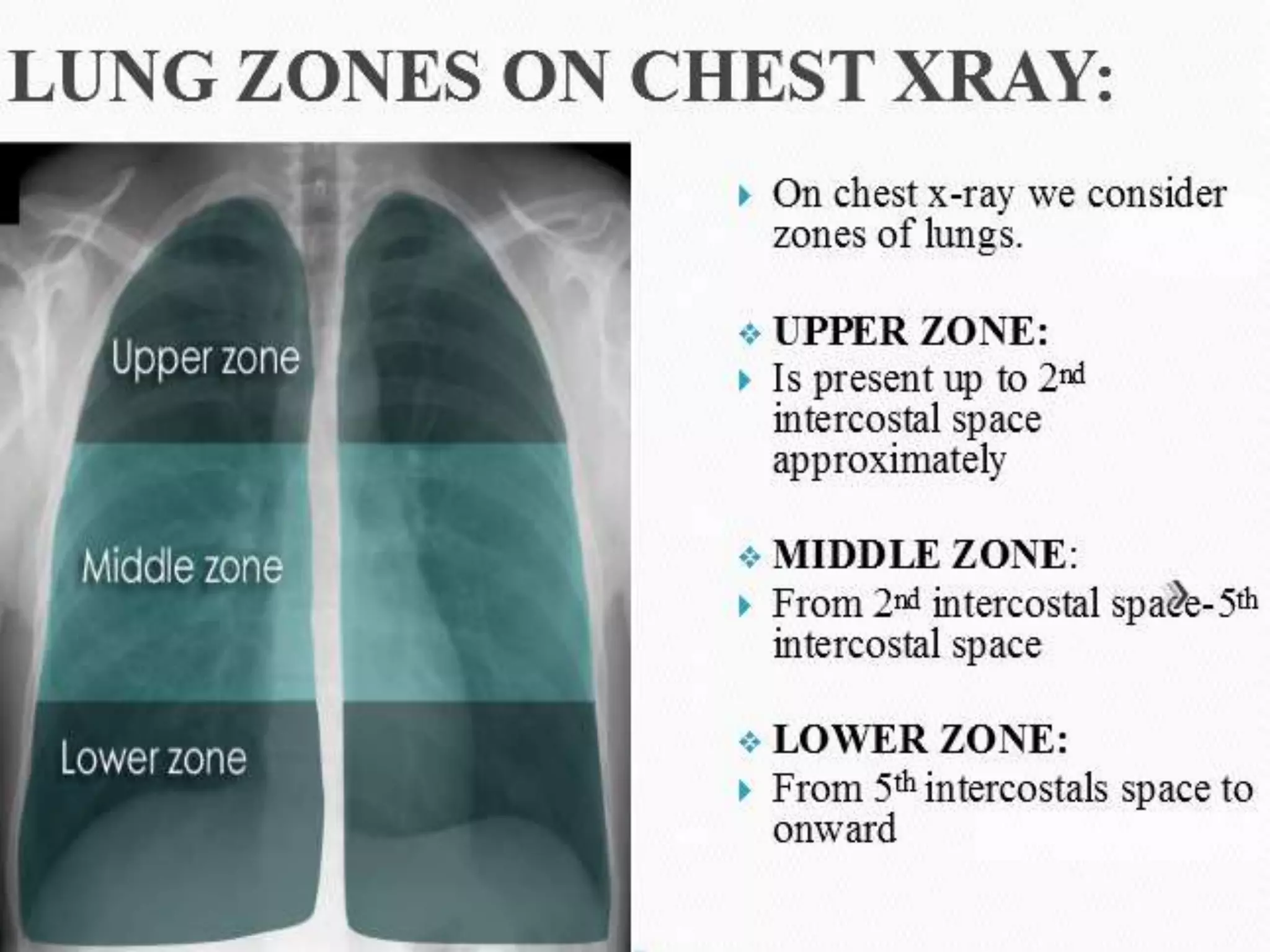 rad ana of chest.pdf