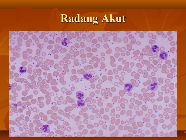 Radang dan-perbaikan3