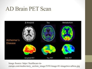 Radha_Chafle_303_ALZHEIMER’S DISEASE AND PARKINSON DISEASE.pptx