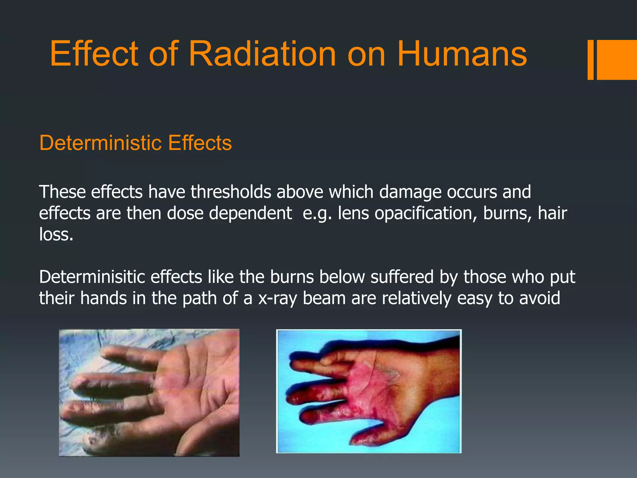 Radiaition hazard and sefety in cath lab | PPTX