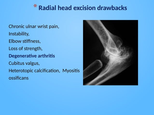 radial-head-fractures-treatment-lecture.pptx | Death, Injury, or ...