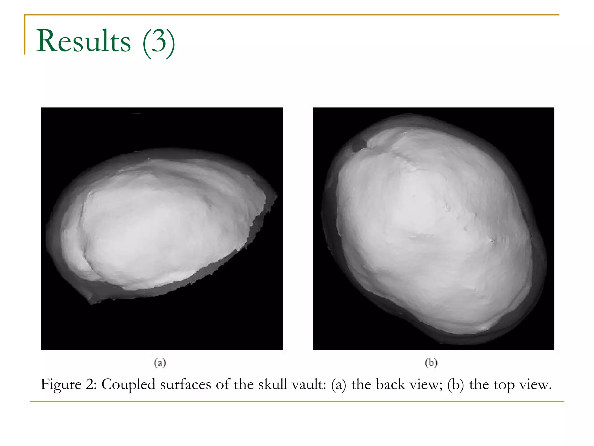 Radial Thickness Calculation and Visualization for Volumetric Layers ...
