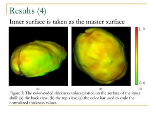 Radial Thickness Calculation and Visualization for Volumetric Layers ...